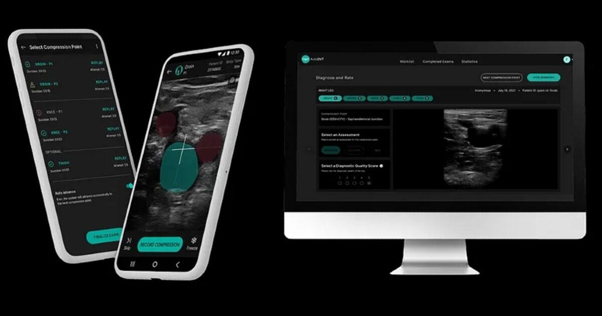 AIM2Flourish | A New Approach to Deep Vein Thrombosis (DVT)